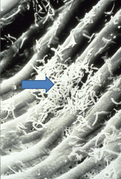 Sugarcane Disease Detection Lab | LSU Department of Plant Pathology and ...